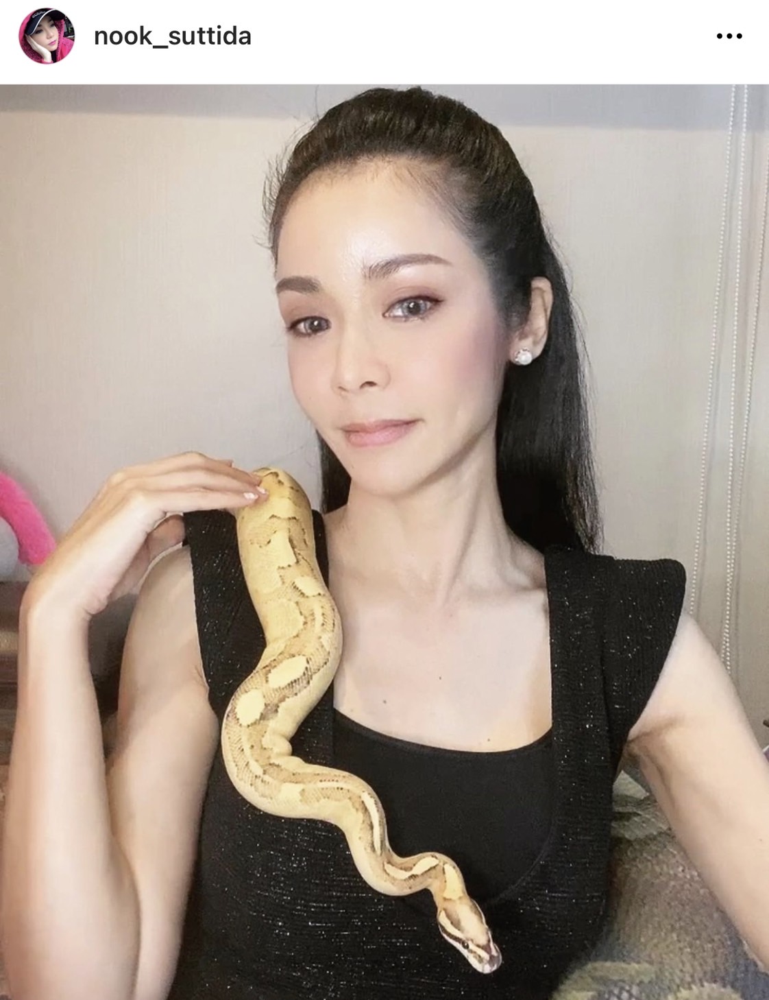 วินาทีชีวิต "นุ๊ก สุทธิดา" ต้องต่อสู้มะเร็งไทรอยด์ เผชิญปัญหาสารพัดโรครุมเร้า