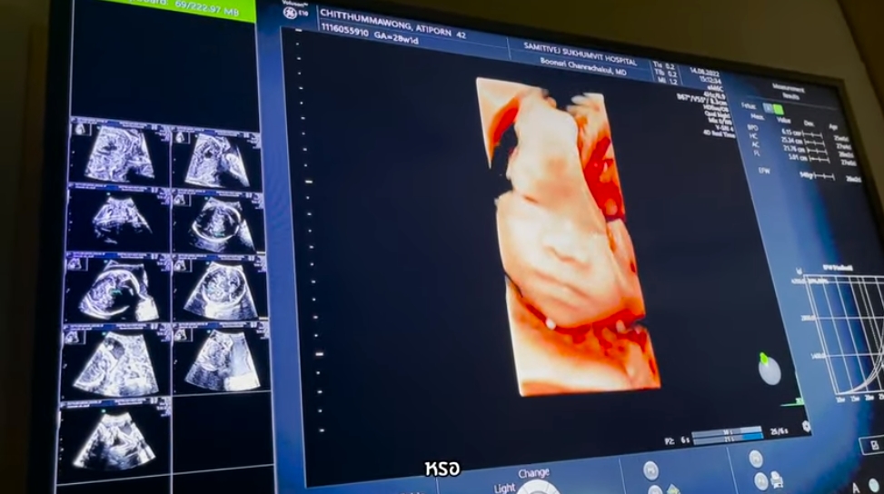 ดูชัดๆ ส่องฝาแฝดน้องสาว "พี่ธีร์-พี่พีร์" หน้าเหมือนใคร?! ดูออกเลย!!